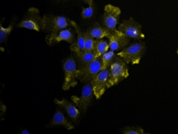 MOC1 Mouse Oral Squamous Cell Carcinoma (OSCC) Cell Line | SCC469